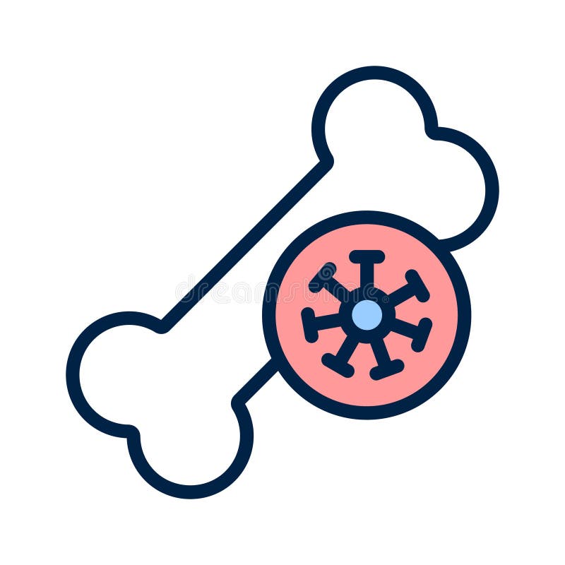 Infected Bone stock illustration. Illustration of bacteria - 332681355