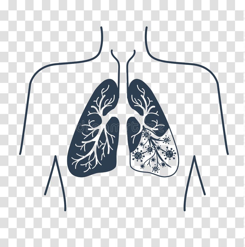 Icon Of Lung Pneumonia Stock Illustration Illustration Of Disease