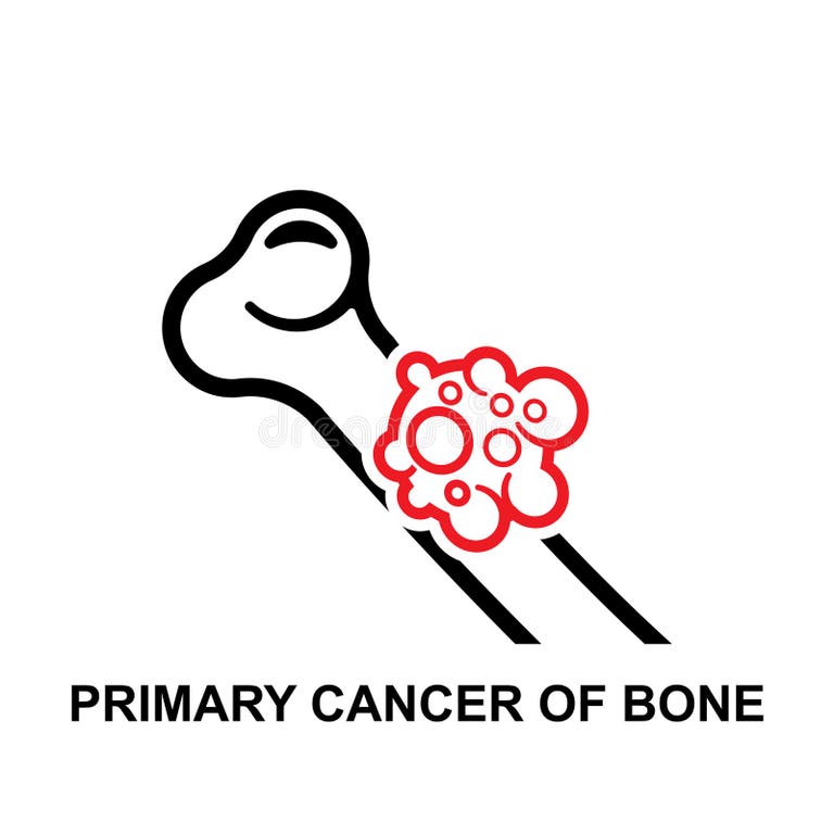 Primary Tumor Stock Illustrations – 83 Primary Tumor Stock ...