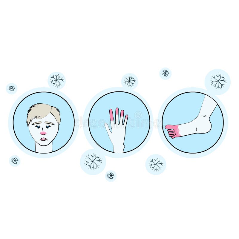 Icons on the Theme of Frostbite and Cold Danger. Vector Stock Vector ...