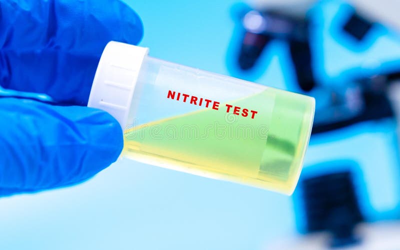 Identifies Nitrites in Urine, a Marker for Urinary Tract Stock Image ...