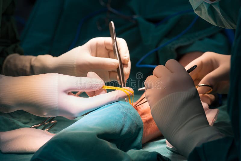 Arteriovenous Stock Photos - Free & Royalty-Free Stock Photos from ...