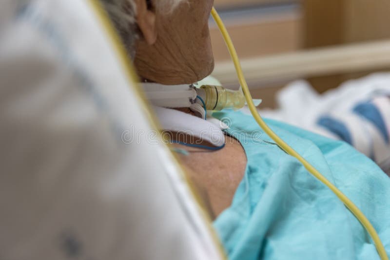 Il Paziente Fa La Tracheotomia Ed Il Ventilatore In Ospedale Fotografia ...