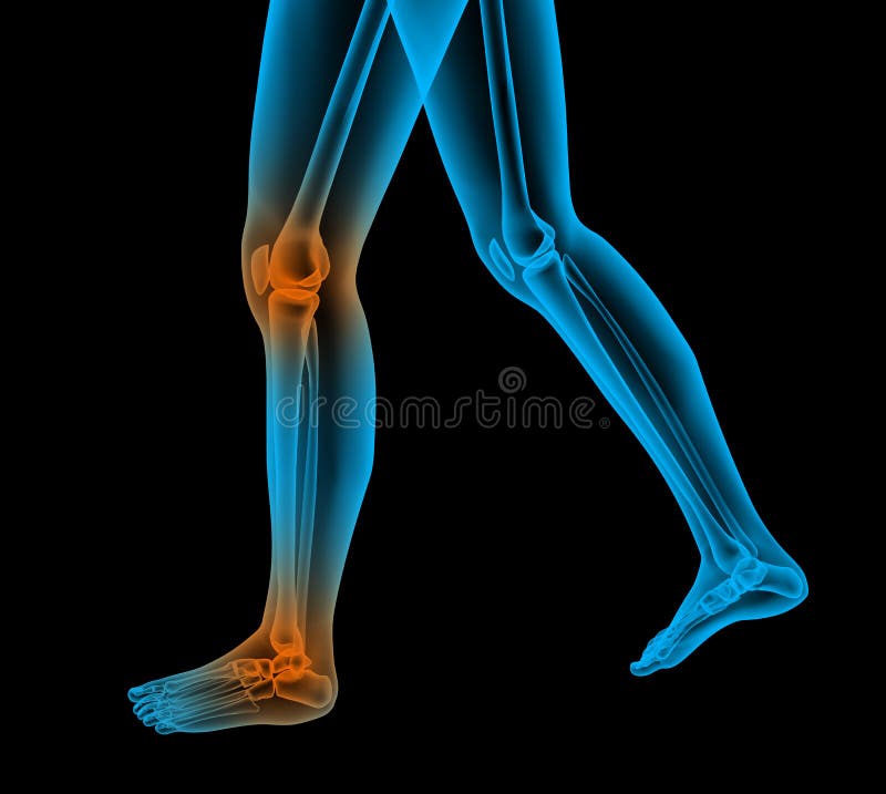 Il piede doloroso rende illustrazione di stock. Illustrazione di medico ...