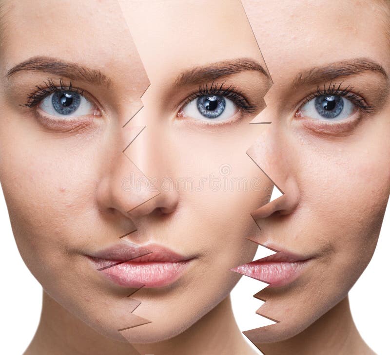 Il Ritratto Della Donna Prima E Dopo Ritocca Immagine Stock - Immagine ...