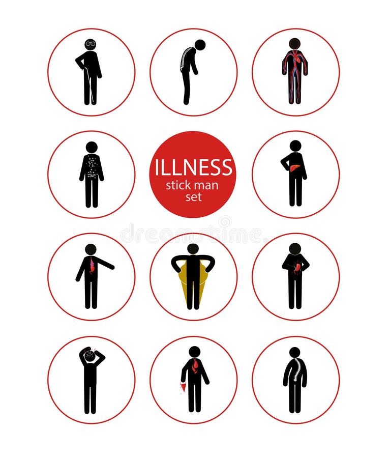 Illness stick man set stock vector. Illustration of cirrhosis - 68167907