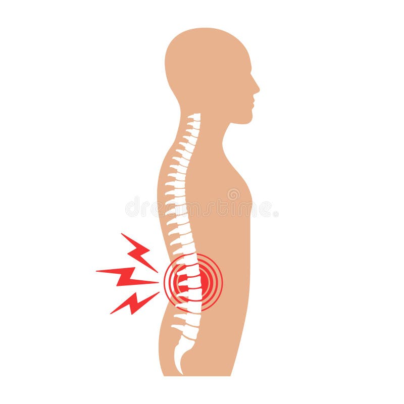 Illustration of Back Pain. Spine Ache Stock Vector - Illustration of ...