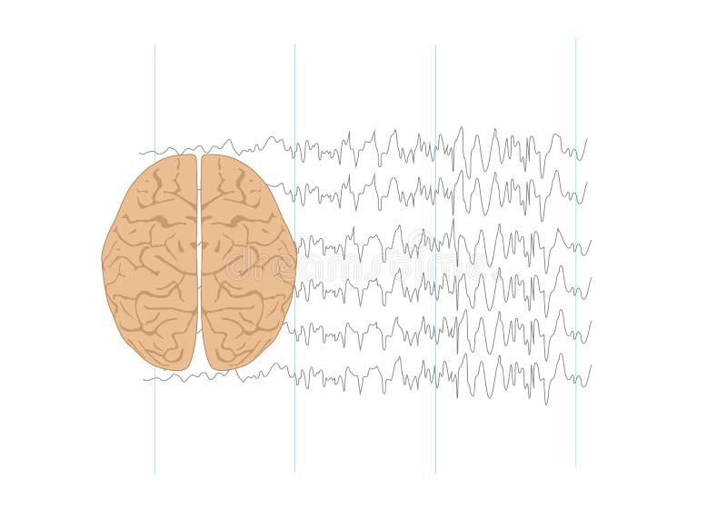Illustration of Brain and Abnormal Brain Waves Stock Vector ...