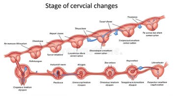 Illustration of Cervical Changes with Labeled Sections. the Diagram ...