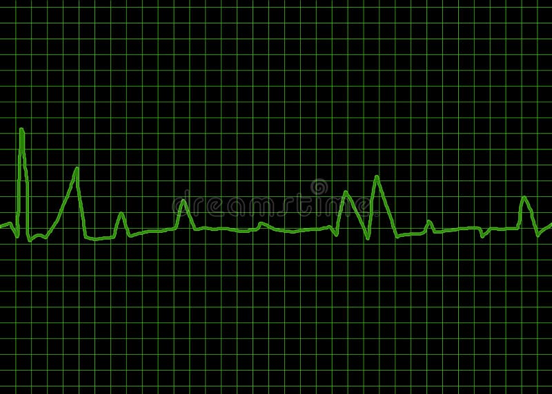 Illustration of the Charts Going Up and Down Stock Illustration ...