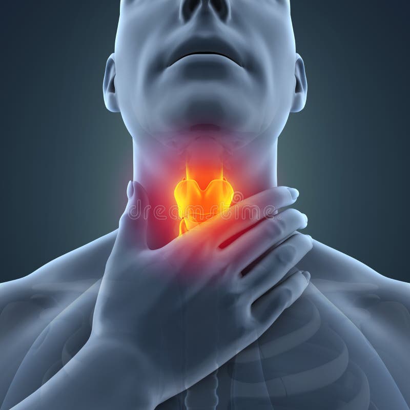 Angine Stock Illustrations, Vecteurs, & Clipart – (967 Stock Illustrations)