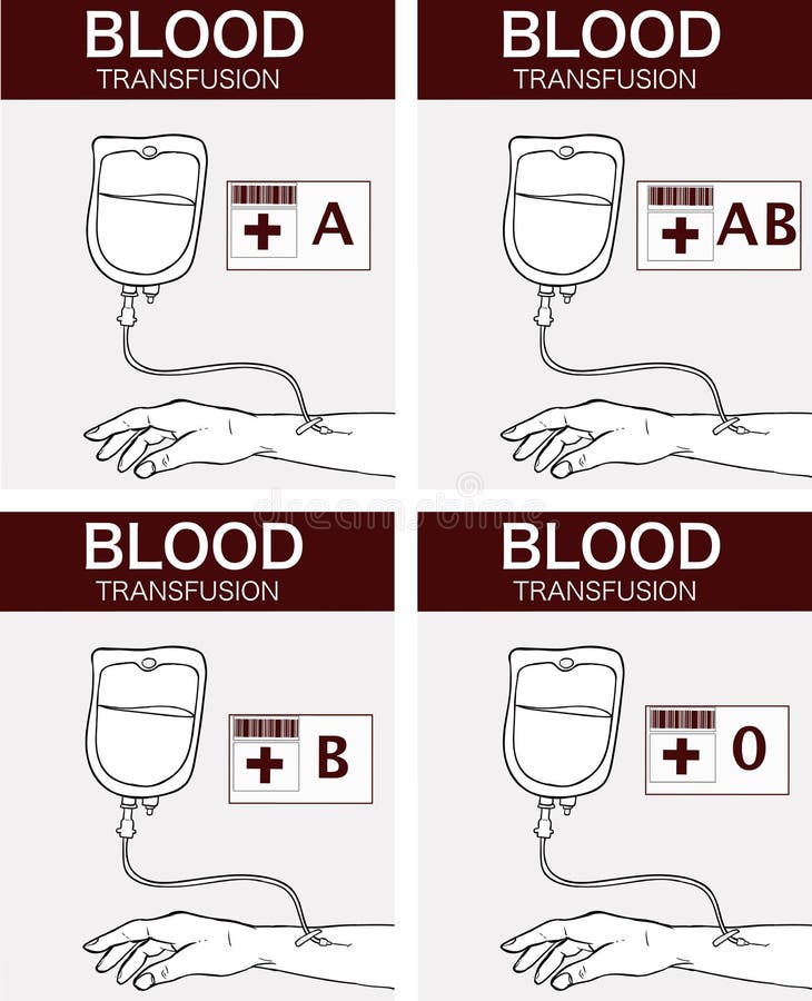 ILLUSTRATION DE VECTEUR D'UNE TRANSFUSION SANGUINE Illustration de ...