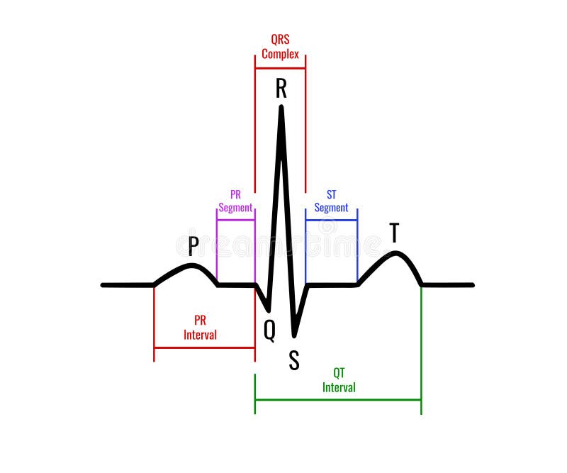 Illustration of ECG Interpretation. ECG of a Healthy Person Stock ...
