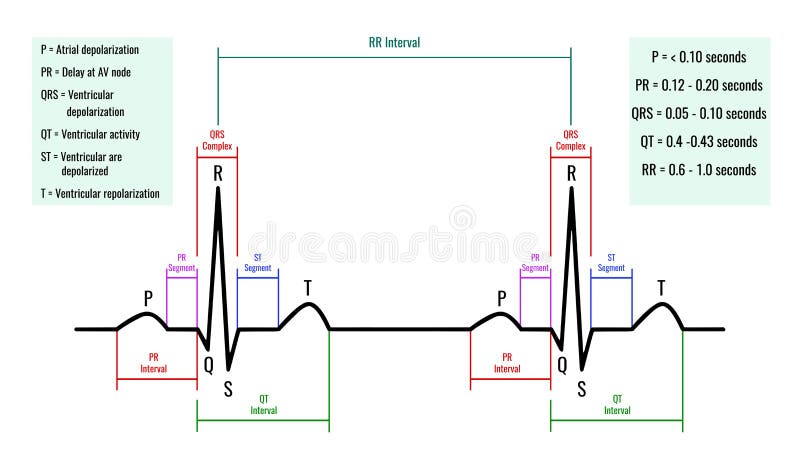 Illustration of ECG Interpretation. ECG of a Healthy Person.Useful for ...
