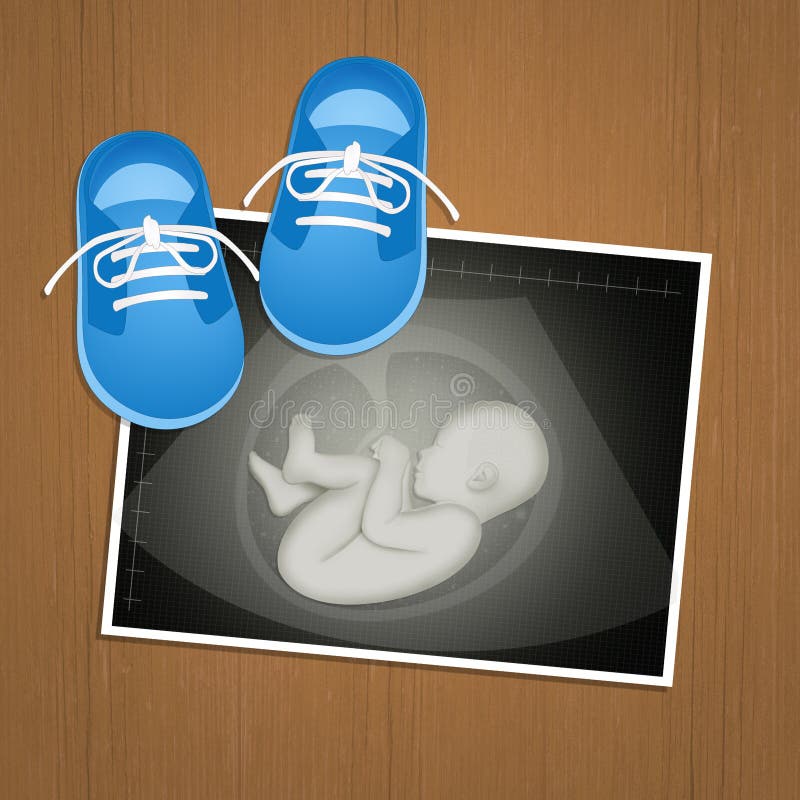 Echography Illustration Stock Illustrations – 239 Echography ...
