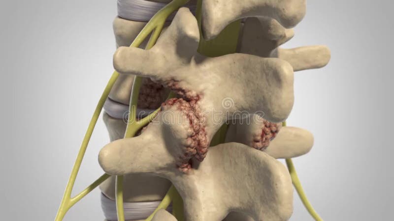 Healthy Lumbar Vertebrae And Intervertebral Disc Labeled Illustration