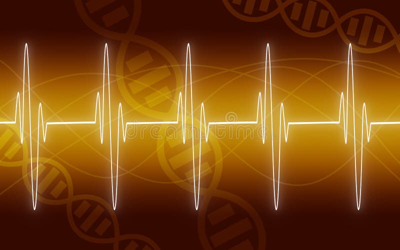 Illustration of EKG Trace on Yellow Background Stock Illustration ...