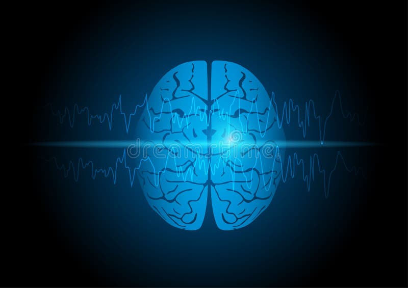 Illustration of Focal Seizure and Human Brain Stock Vector ...