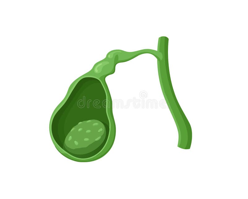 Illustration of the Gallbladder Mass. Vector Image of the Gallbladder ...