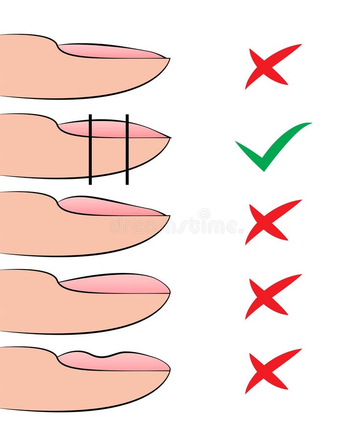 Illustration with Hardware Manicure Technology. Correct Formation of ...
