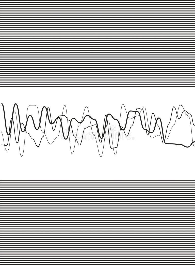 Eeg Recording Stock Illustrations – 22 Eeg Recording Stock ... Eeg Recording Stock Illustrations – 22 Eeg Recording Stock ...