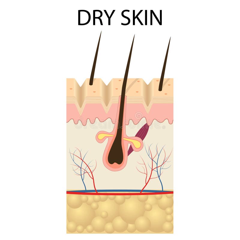 Dry Skin Anatomy Stock Illustrations – 644 Dry Skin Anatomy Stock ...