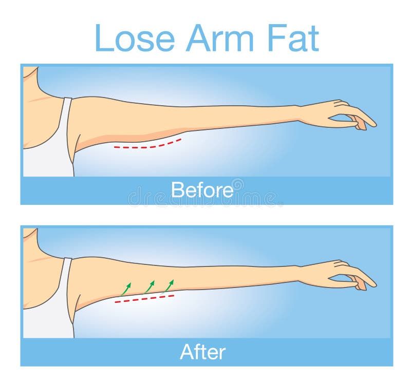 Fat Drop Icon Stock Illustrations – 1,561 Fat Drop Icon Stock ...