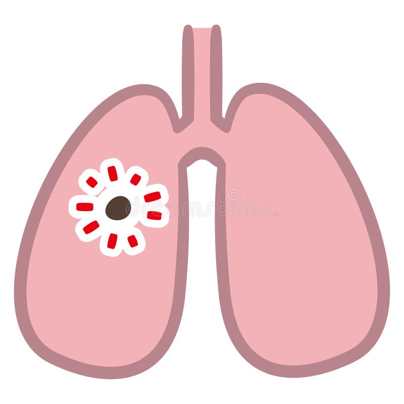 Illustration of Lungs on White Background, Aspiration Stock Vector ...
