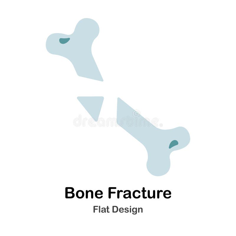 Illustration Plate De Fracture Illustration de Vecteur - Illustration ...