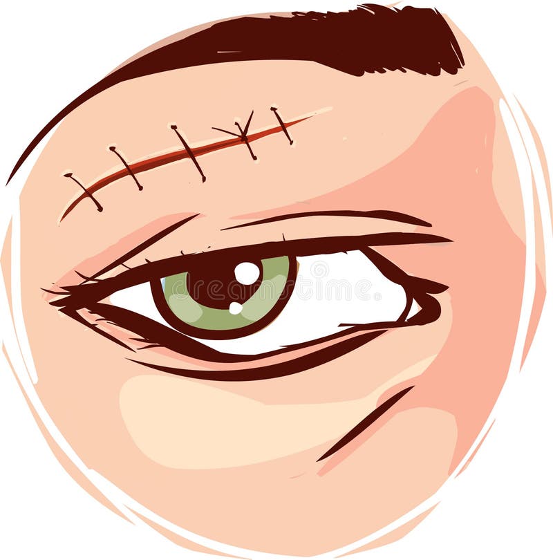 Illustration of a Receiving First Aid, Injury or Cut and Sutured Face ...