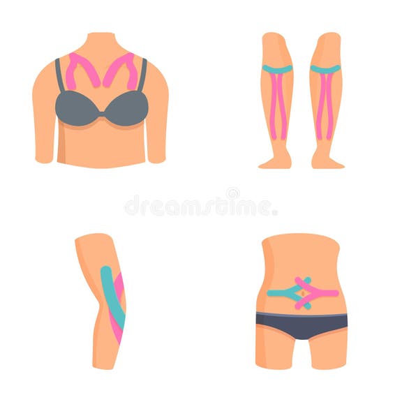 Kinesio Taping Stock Illustrations – 170 Kinesio Taping Stock ... Kinesio Taping Stock Illustrations – 170 Kinesio Taping Stock ...