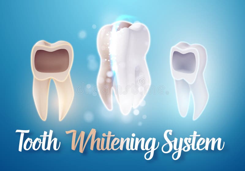 Vector Tooth Icon. Realistic Teeth on Transparent Overlay Background ...