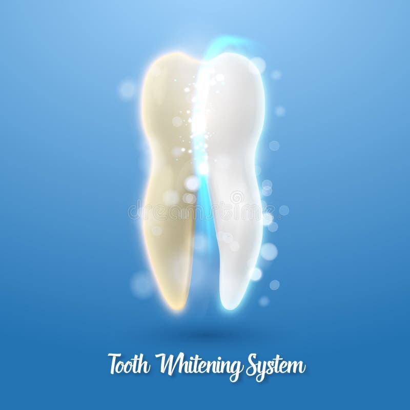 Vector Teeth Cleaning Process. 3D Realistic Vector Teeth Whitening ...
