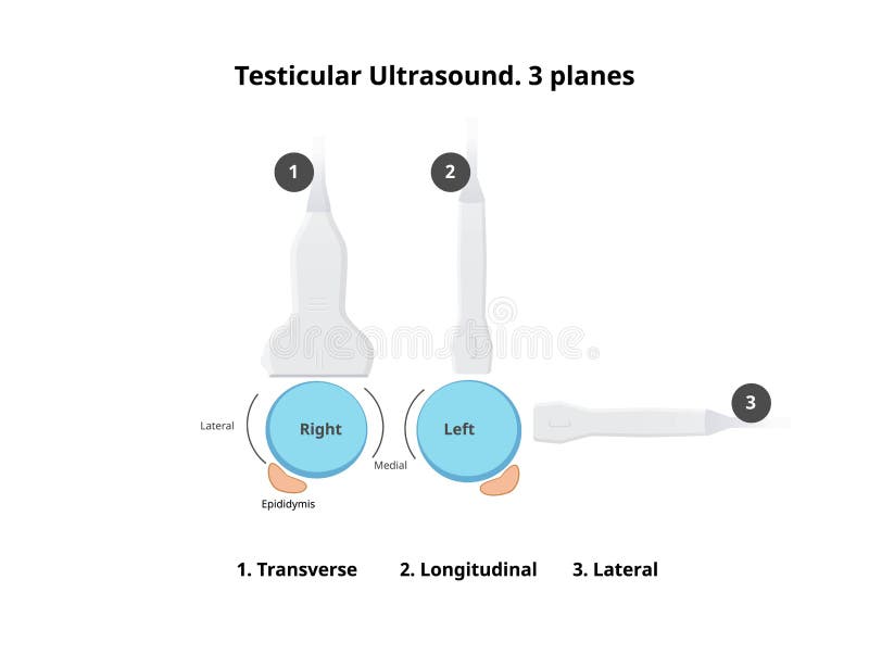 Ilustración Esquemática De La Ecografía Testicular Ilustración Del