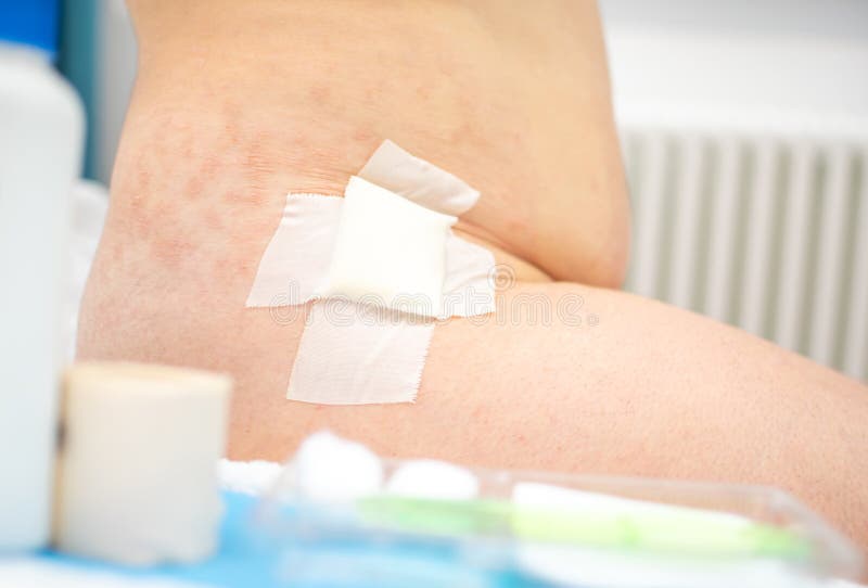 Body Sitting with Signs of Dermatitis and with Hand Touching Wound with ...