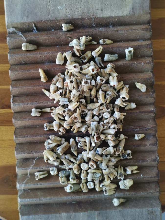 The Bundle of Unwanted Extracted Decay Human Teeth. Stock Photo - Image ...