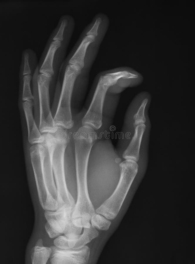 Images Vue D Anatomie De Main Et De Poignet - Téléchargez 62 Photos ...