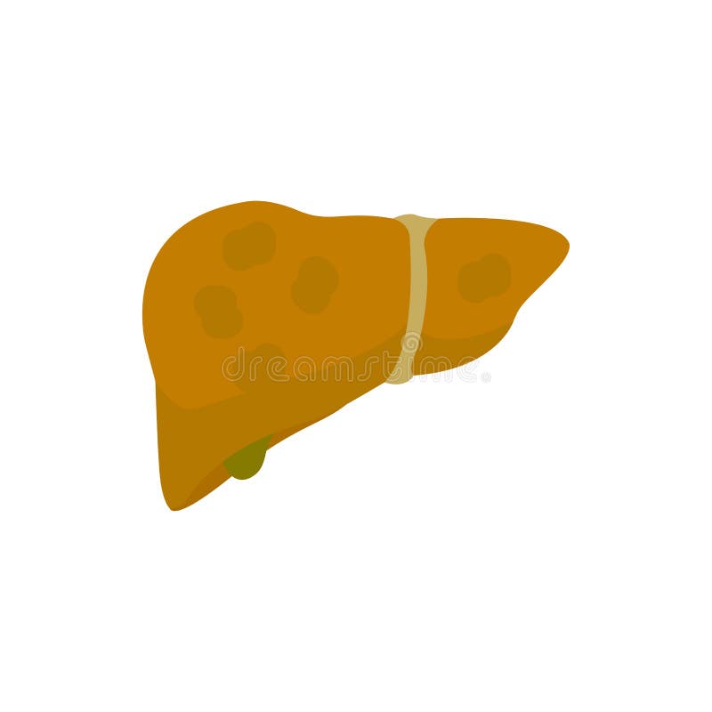 Image of Fatty Liver, Disease, Vector Illustration Stock Vector ...