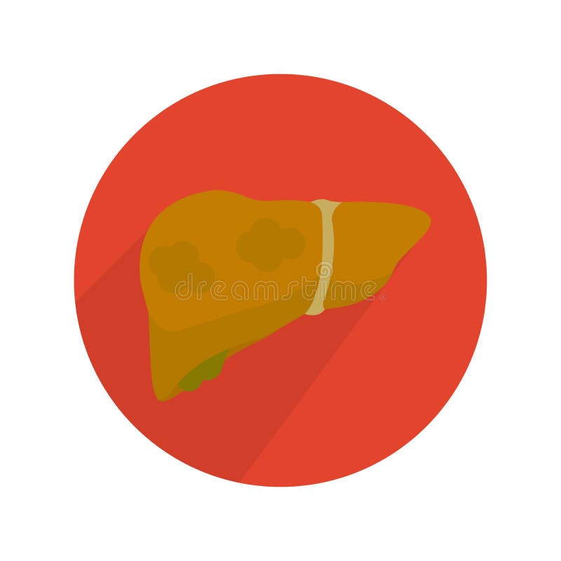 Image of Fatty Liver, Disease, Vector Illustration Stock Vector ...