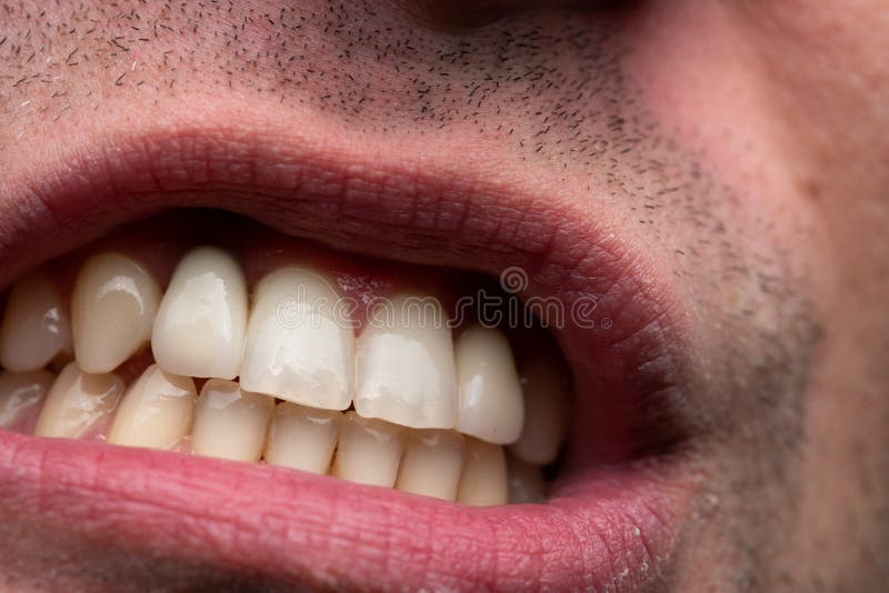 Image of Man with Open Mouth, Close Up Photo Stock Photo - Image of ...