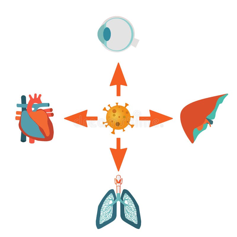 Image of Organs Affected by the Disease, Vector Illustration Stock ...