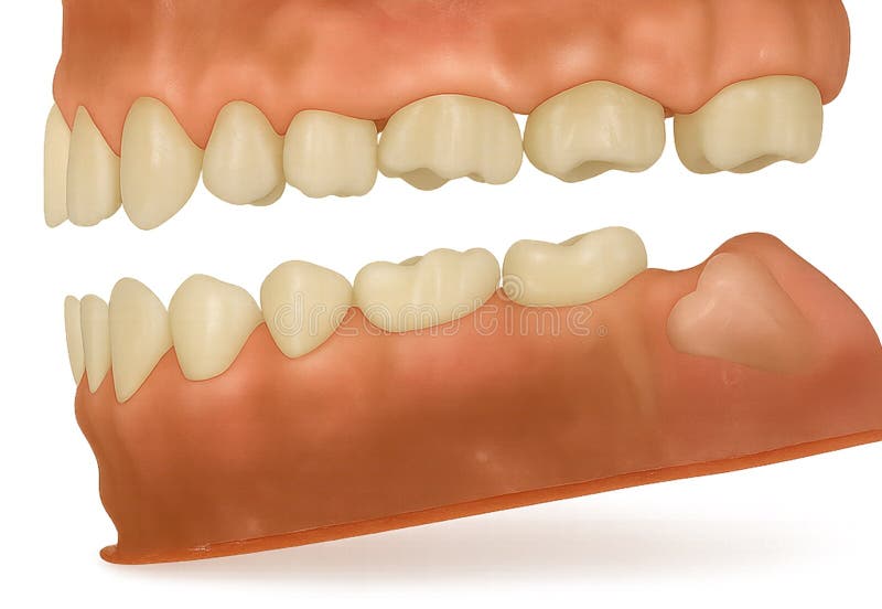 Mollars Eruption Dental stock photo. Image of patient - 392814780