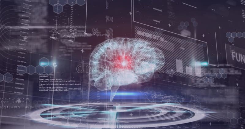 Image of Scope Scanning and Data Processing Over Brain Stock Image ...