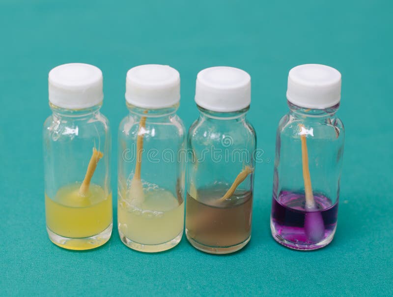This Image Show Finding Coliform Bacteria Contamination in Food Stock ...