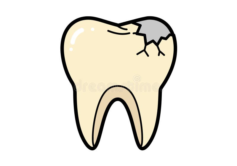 Broken teeth clipart stock vector. Illustration of cracked - 364073012