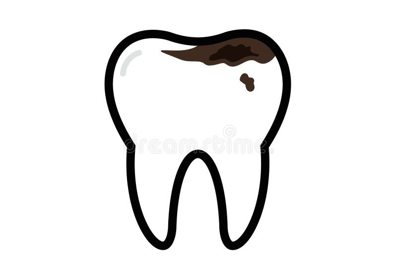 Tooth cavity clipart stock vector. Illustration of outline - 364073633