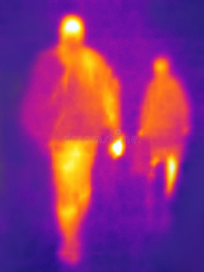 The Image from Thermal Imager Device Stock Image - Image of medicine ...
