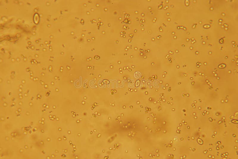 Urine Under Microscope Stock Photos - Free & Royalty-Free Stock Photos ...