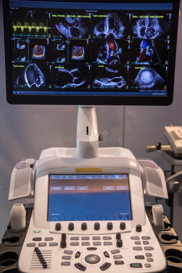 Imagem Do Ultrassom Do Coração No Tela De Computador E No Cardiograma ...