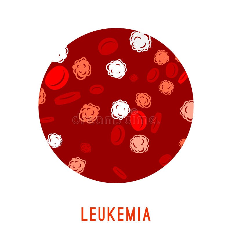 Imagen De La Conciencia De La Leucemia Ilustración del Vector ...